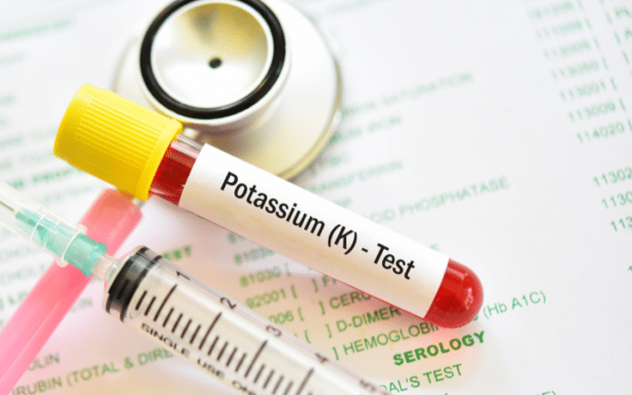 Top 13 Causes of Low Potassium: Unraveling the Mystery of Hypokalemia