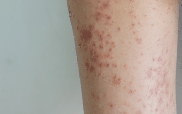 Identifying Pancreatic Cancer Symptom - 21 Warning Signs You Need to Know