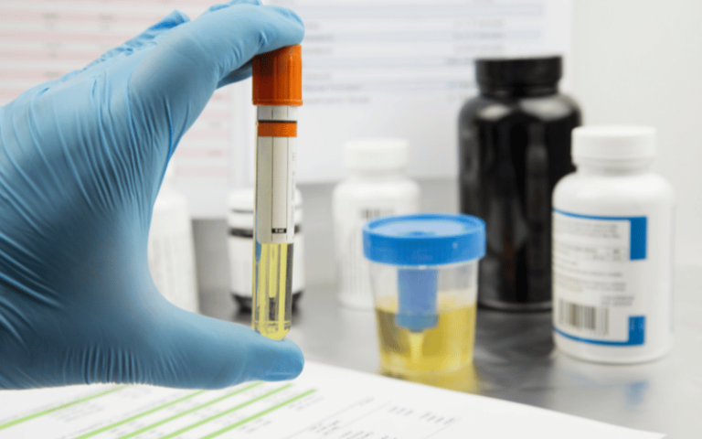 Understanding Acute Kidney Disease and Its Symptoms: A Thorough Exploration