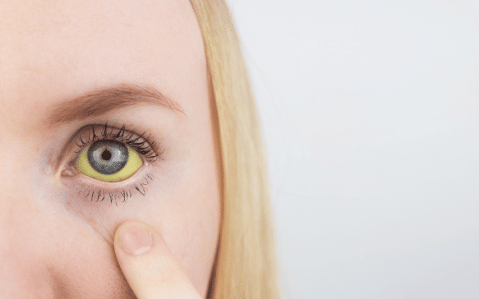 Understanding Alagille Syndrome: 10 Key Symptoms You Should Know