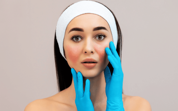 10 Cluster Headache Symptoms: Recognizing the Pain and Finding Relief ...