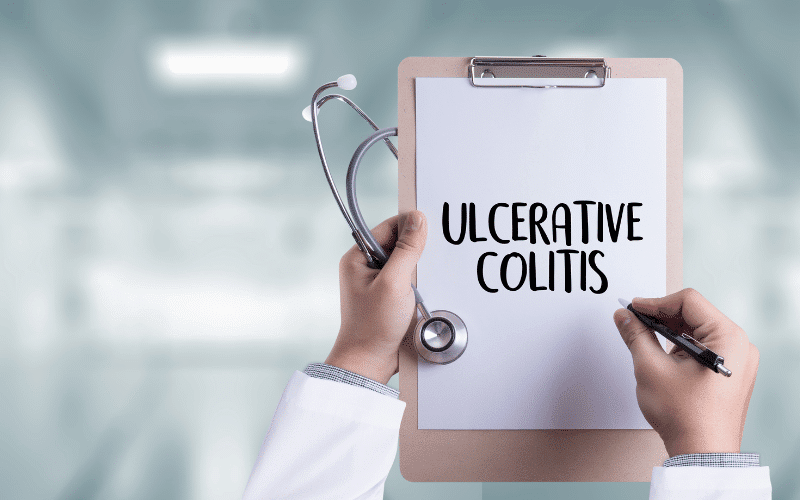 15 Early Signs of Ulcerative Colitis: Recognizing the First Symptoms of UC