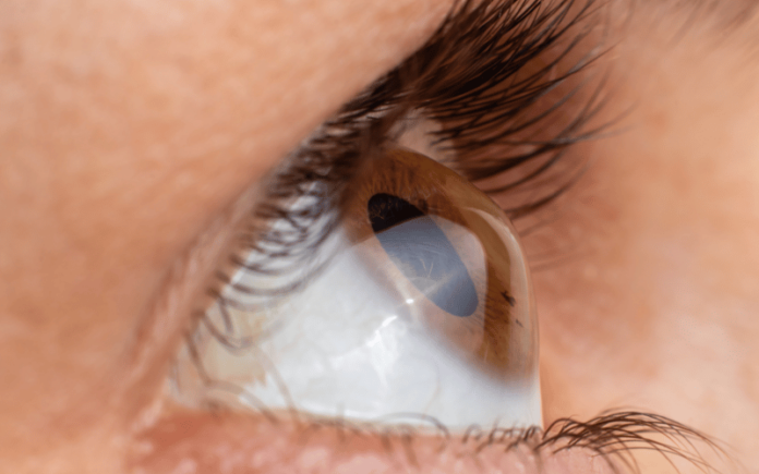 20 Common Eye Conditions and Diseases: Spot the Signs and Symptoms ...