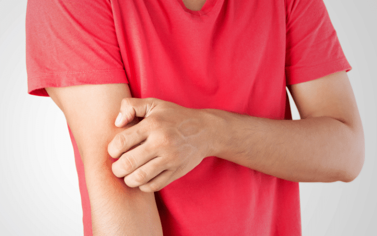 Lupus Nephritis: 15 Symptoms You Need to Know - Page 6 of 16