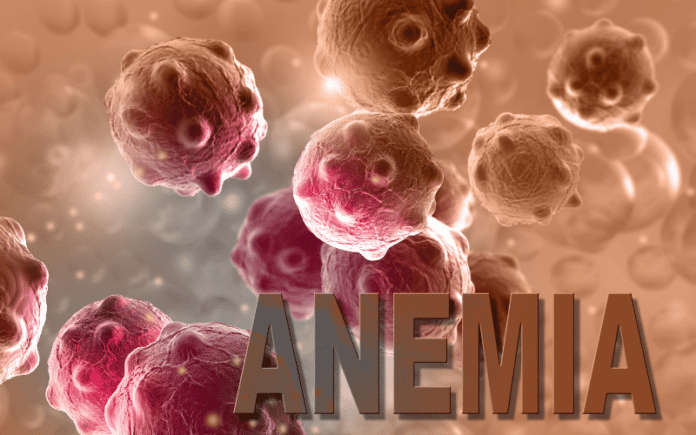 15 Telltale Signs and Symptoms of Anemia: Recognizing the Red Flags