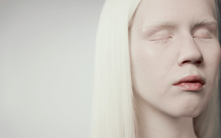 10 Telltale Signs of Iron Deficiency in Women: Unmasking the Hidden ...