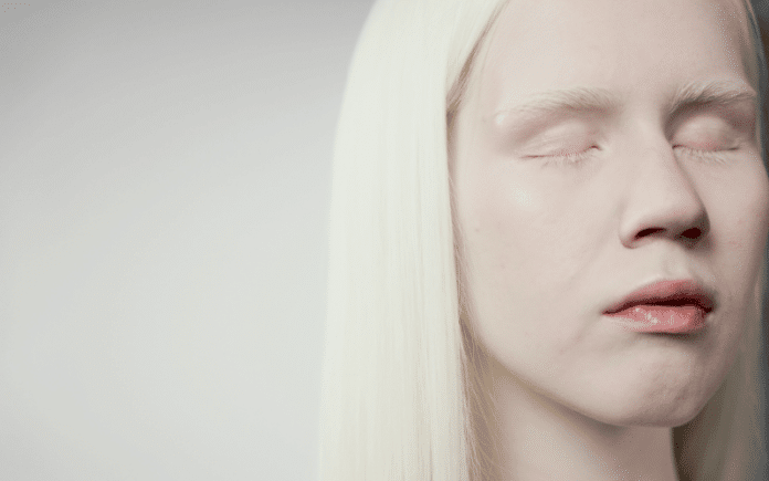 Understanding Megaloblastic Anemia: Top 10 Symptoms and More - Page 3 of 11