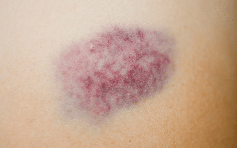 Recognizing the 15 Signs and Symptoms of Liver Damage - Page 9 of 16