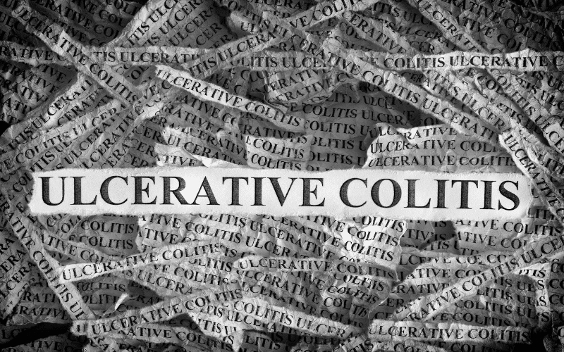 10 Ways to Fight Fatigue From Ulcerative Colitis: Regain Your Energy ...