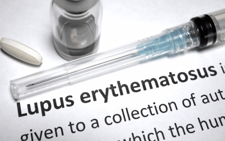 Unmasking Lupus: An In-depth Look at Its Five Forms - Page 2 of 6