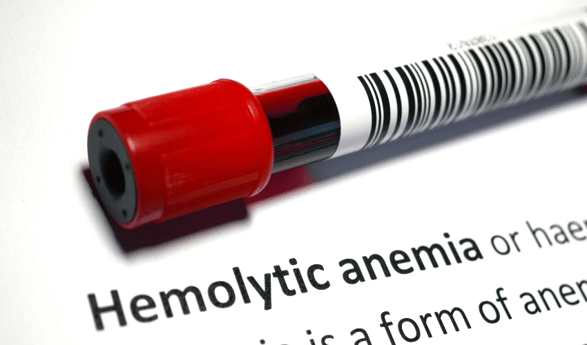 Hemolytic Anemia: 10 Symptoms You Need to Know