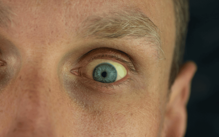 10 First Signs of Liver Problems: Recognizing the Early Warning Signs ...