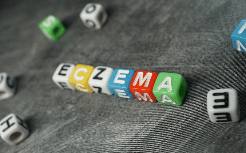 Nummular Eczema: Understanding the 10 Most Common Symptoms