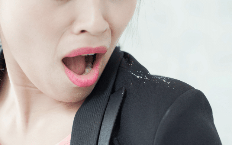 The 10 Common Causes of Seborrheic Dermatitis Uncovered