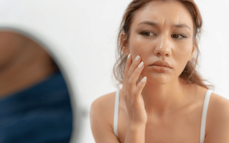 Understanding Contact Dermatitis: Symptoms and Treatment