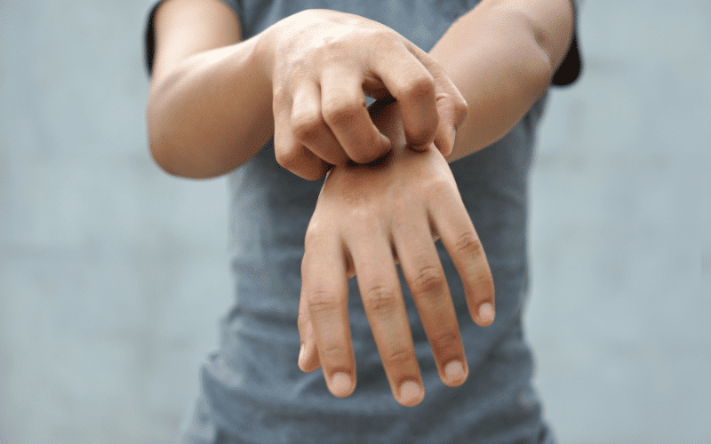 Ringworm (Tinea Corporis): 13 Symptoms You Need to Know About in Humans ...