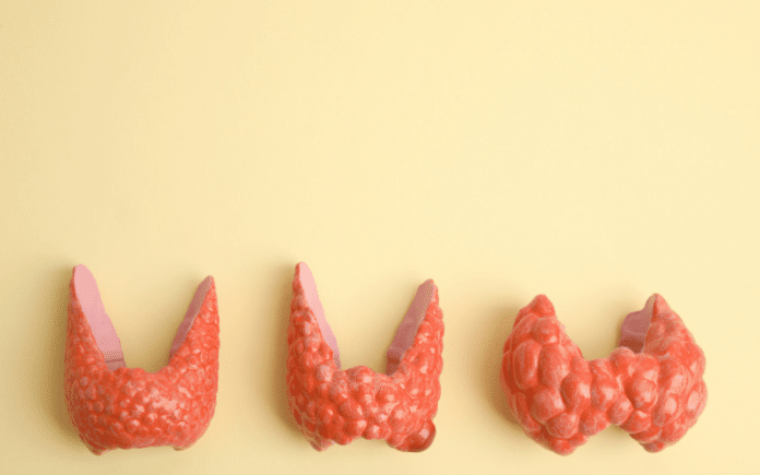 Unraveling the Four Stages of Thyroid Cancer: An In-depth Exploration