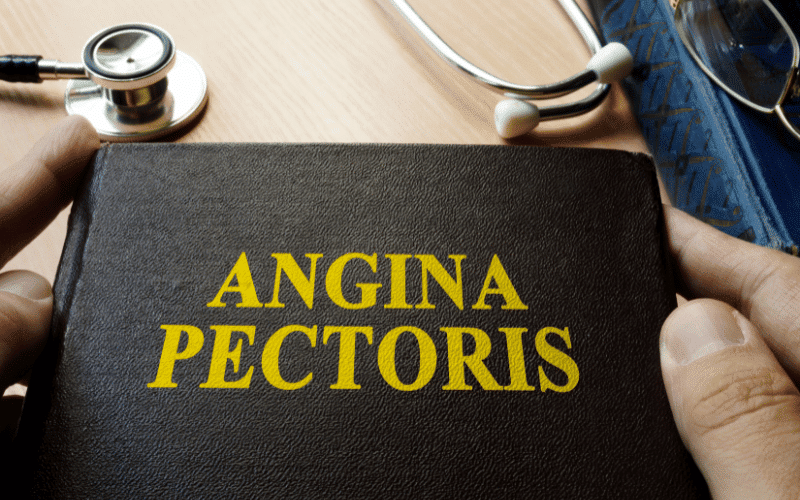 Angina Pectoris Unveiled: A Detailed Exploration of Its Top 10 Symptoms