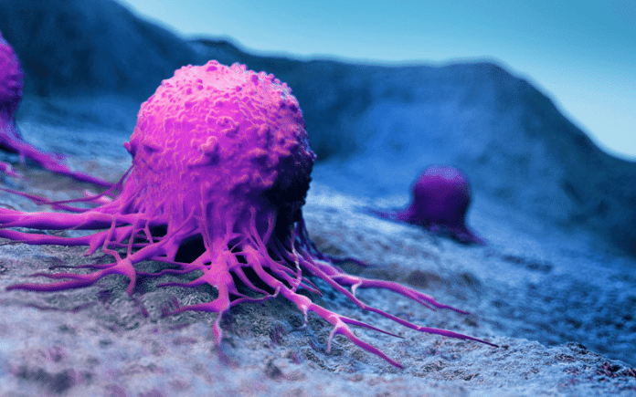 Spotting Cowden Syndrome: The Top 10 Symptoms to Watch Out For