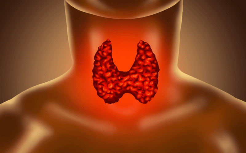 Thyroid Cancer Recurrence: The 5 Symptoms You Need to Know