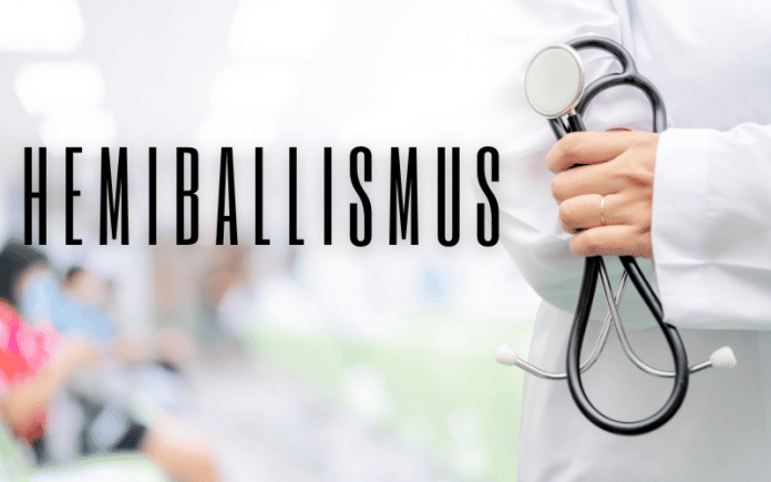 Hemiballismus Revealed: 10 Symptoms to Keep an Eye On