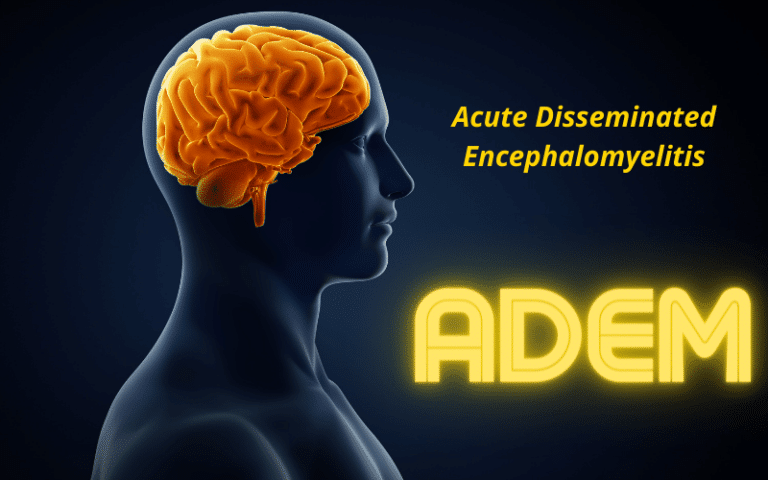 Ten Ways Your Body Cries Out: Recognizing ADEM 10 Most Common Symptoms