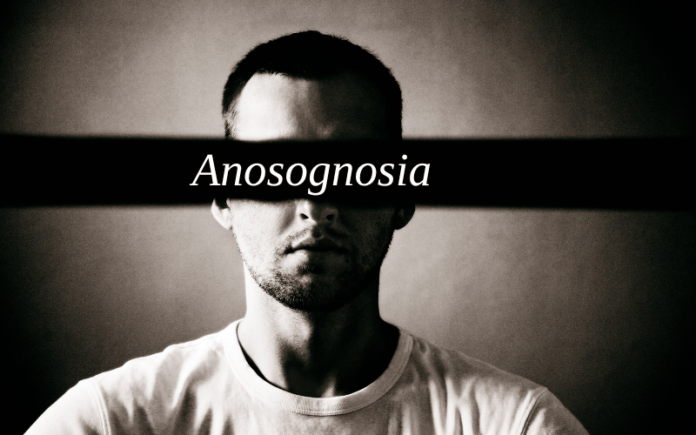 From Denial to Disbelief: Charting the 10 Symptoms of Anosognosia