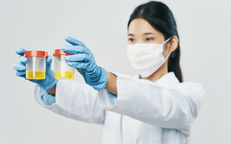 Protein In Urine 10 Causes That Could Be Behind It protein-in-urine-10-causes-that-could-be-behind-it