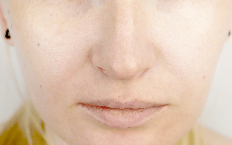 The Telltale Ten Pinpointing Sjogrens Syndrome Symptoms