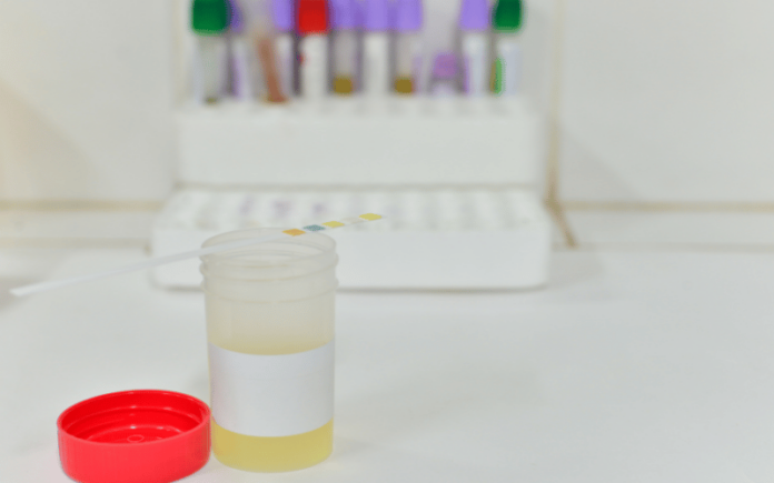 10 Critical Signs of Hemoperitoneum: Know When to Seek Help - Page 8 of 11