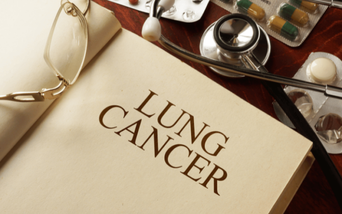 4 Types of Lung Carcinoma: A Look into the Most Common Variants