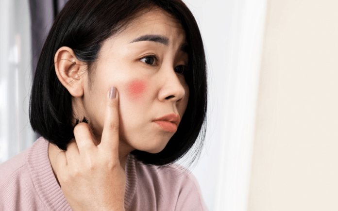 10 Telltale Symptoms of Frey's Syndrome: Understanding Baillarger's ...