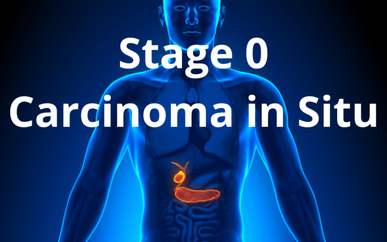 Understanding the 5 Stages of Gallbladder Cancer