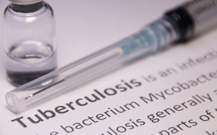 Top 10 Causes of Swollen Parotid Glands (Parotitis) - Page 9 of 11