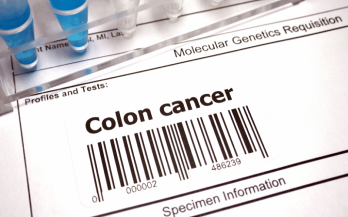 Understanding the Subtle Signs: 10 Symptoms of Stage 1 Colorectal Cancer