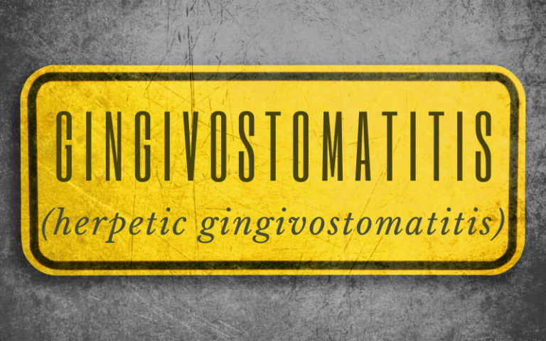 Gingivostomatitis: Identifying 10 Key Symptoms in Kids