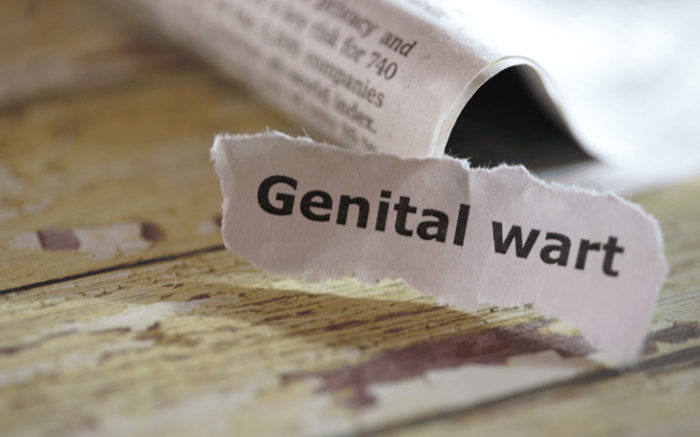 The 10 Most Common Genital Warts Symptoms in Women