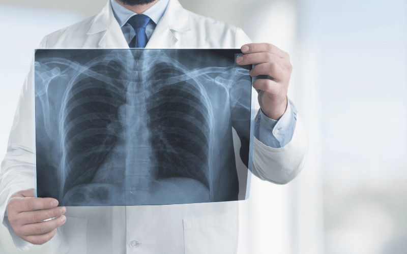 Mastering CPAM: In-Depth Insights and Expert Advice on Congenital ...