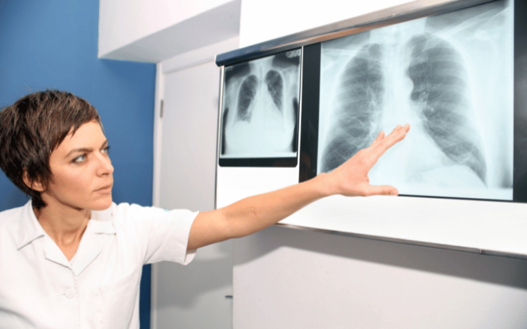 Mastering CPAM: In-Depth Insights and Expert Advice on Congenital ...