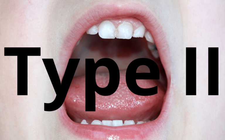 Demystifying Ankyloglossia: A Deep Dive into the Four Types of Tongue ...