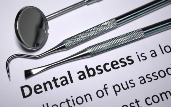 Young Bites, Big Frights: Dental Abscess in Children