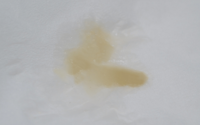 Behind the Discomfort: The Top 10 Symptoms of Proctitis - Page 3 of 11