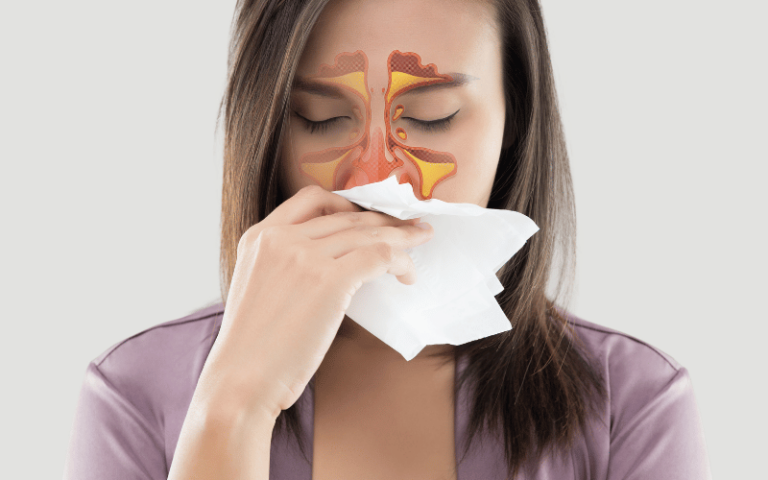 Understanding Atrophic Rhinitis: A Comprehensive Guide